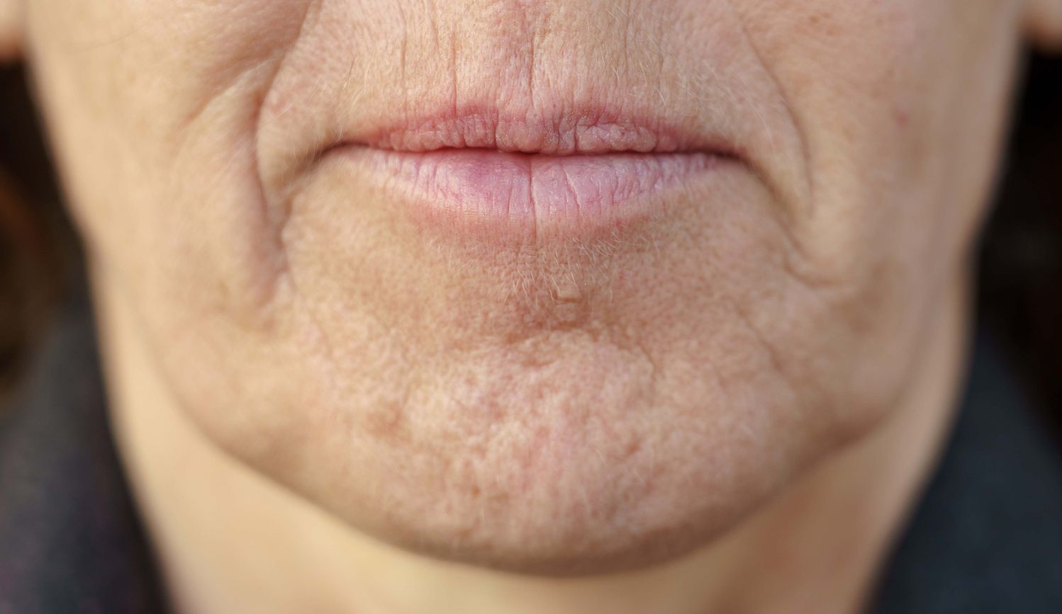 Aesthetic Works Medical Associates | Wrinkles Reduction