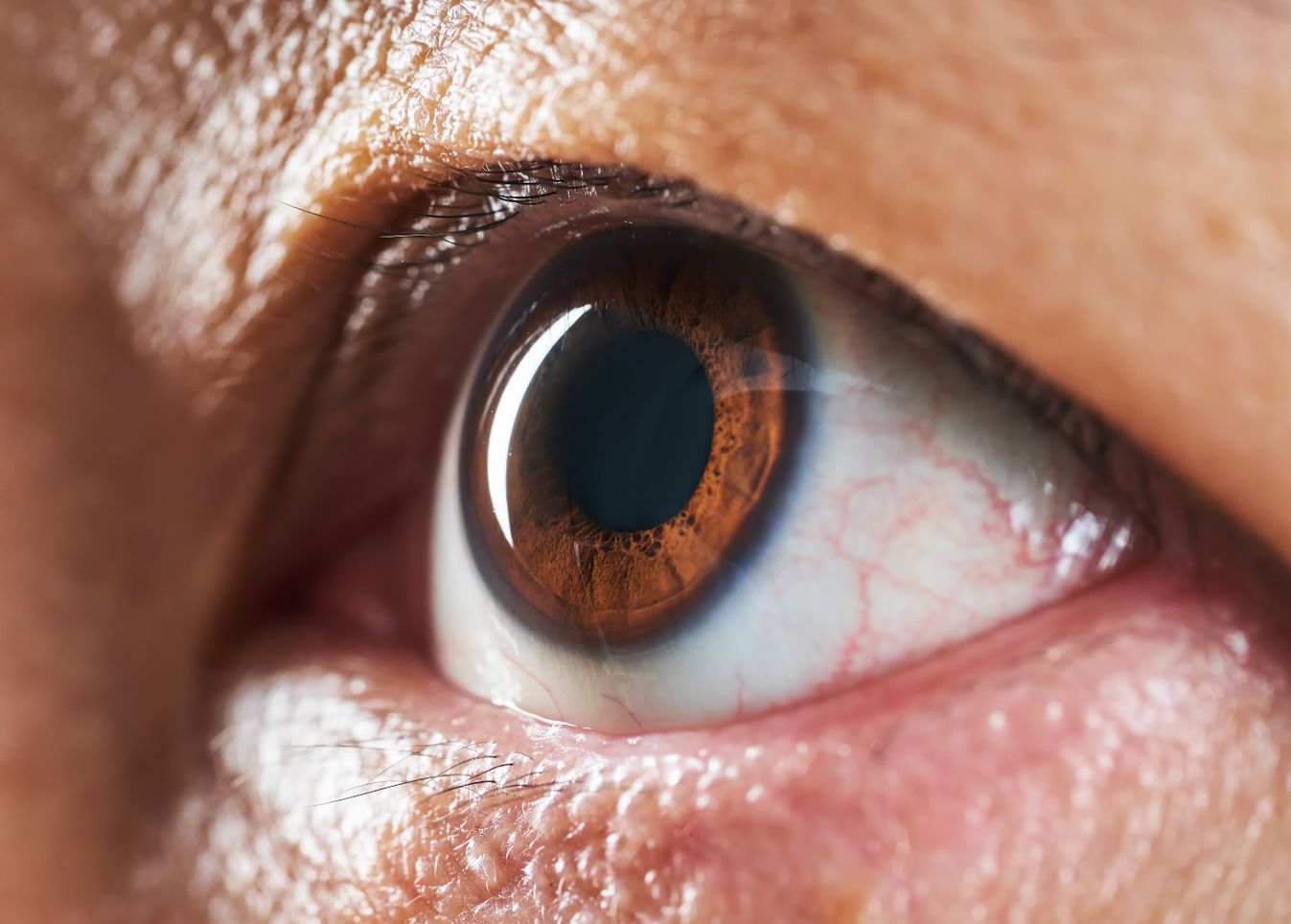 UltraVision Laser Eye Surgery in San Antonio, TX