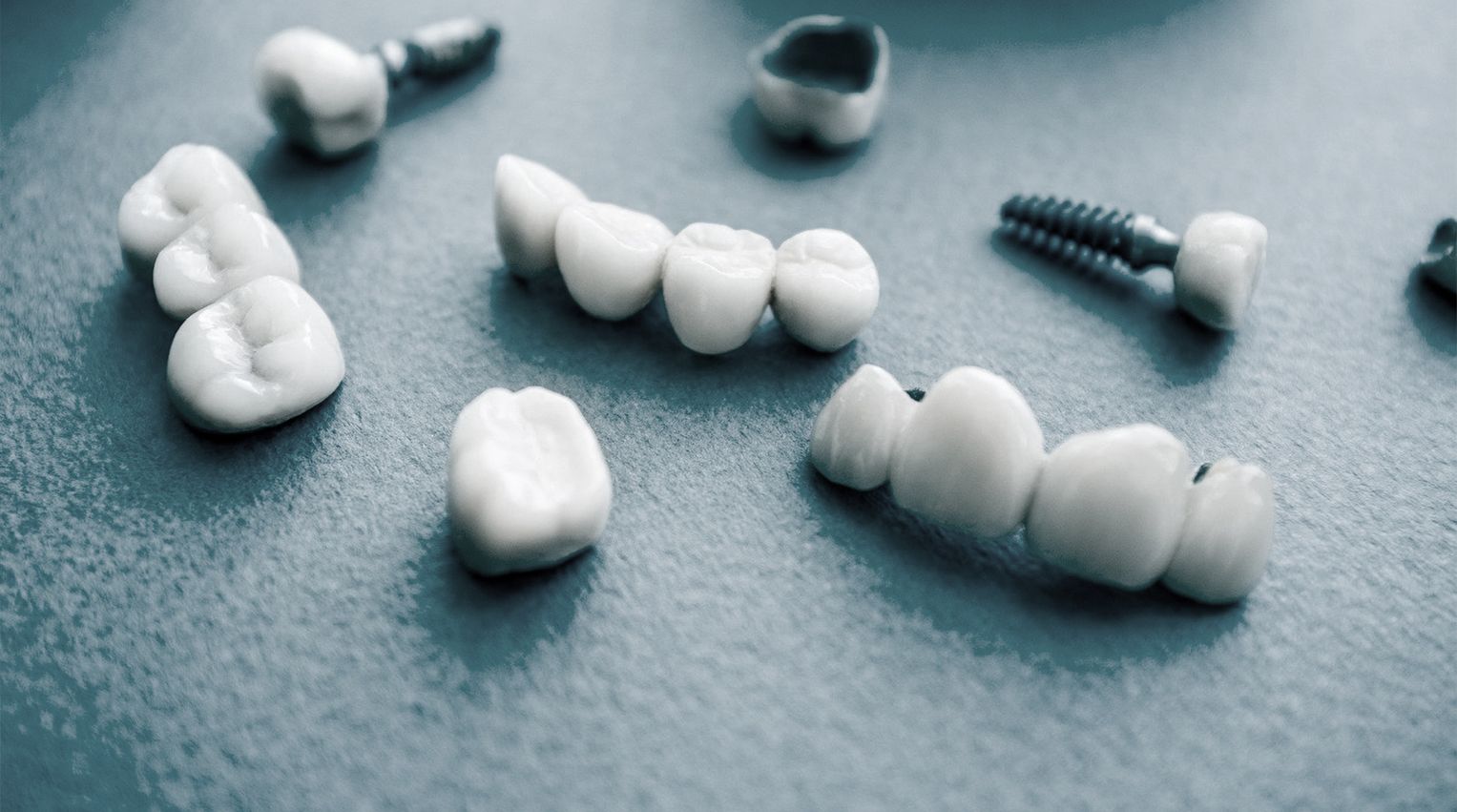 PERFECT FIT DENTAL LAB GROUP | Gallery
