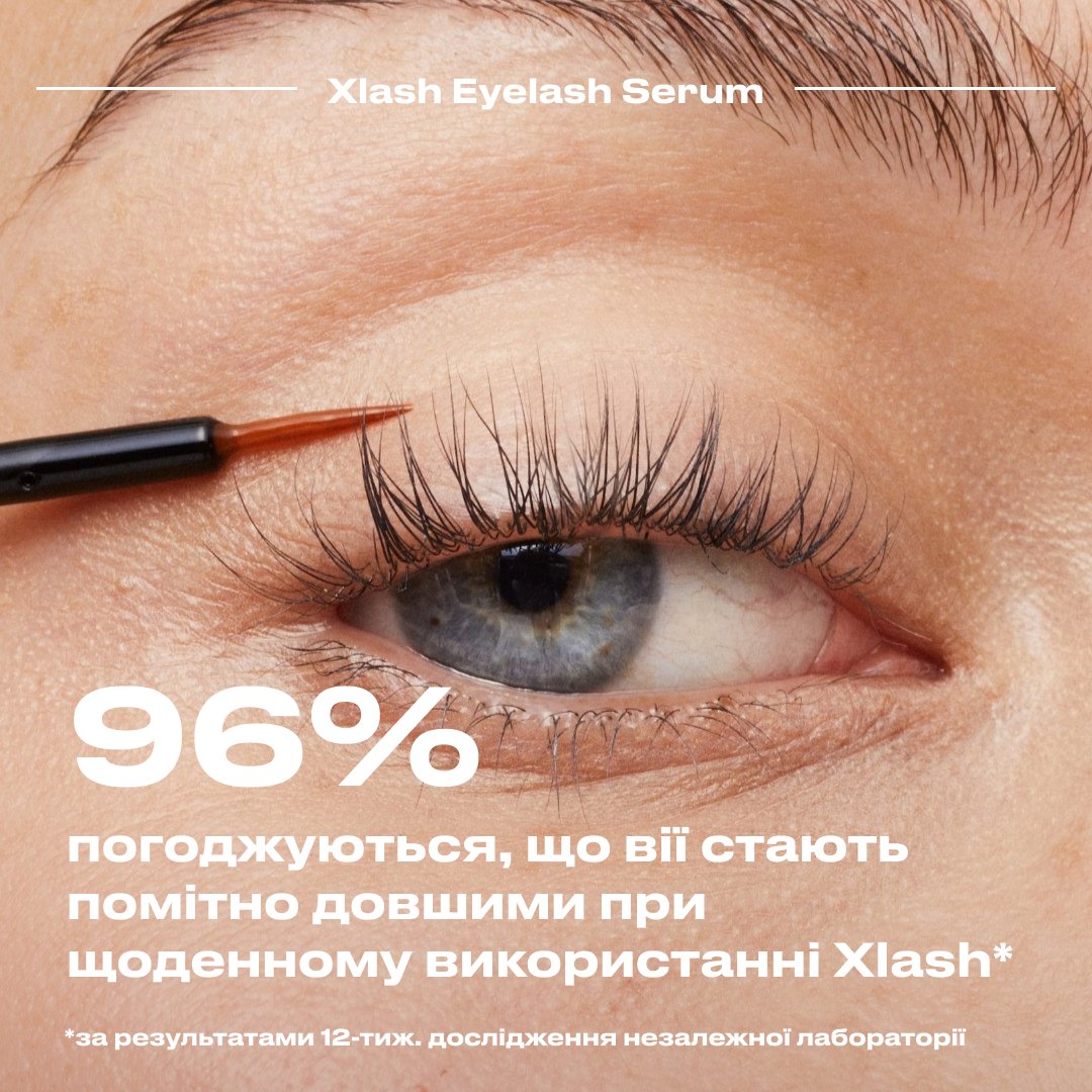 Xlash | Про нас