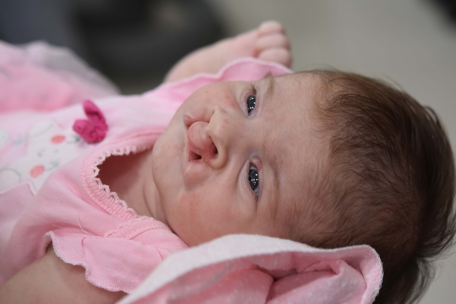 What Are Clefts – Causes, Types and Impact